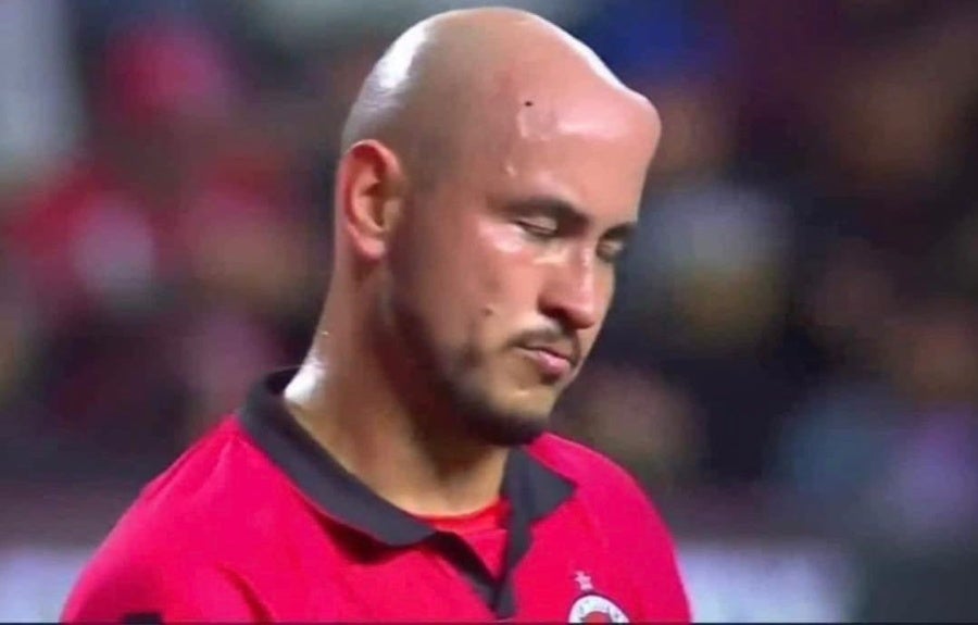 ¿Qué le pasó a 'Cocoliso'? Carlos González recibió golpe ante América y así lució