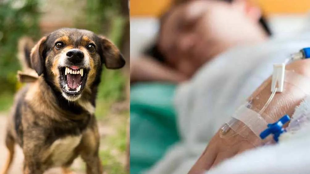 Confirman primer caso de rabia humana en México