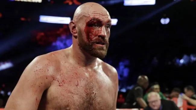 Tyson Fury no considera a Andy Ruz dentro de los cinco mejores ...